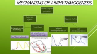 Anti arrhythmic agents | PPT
