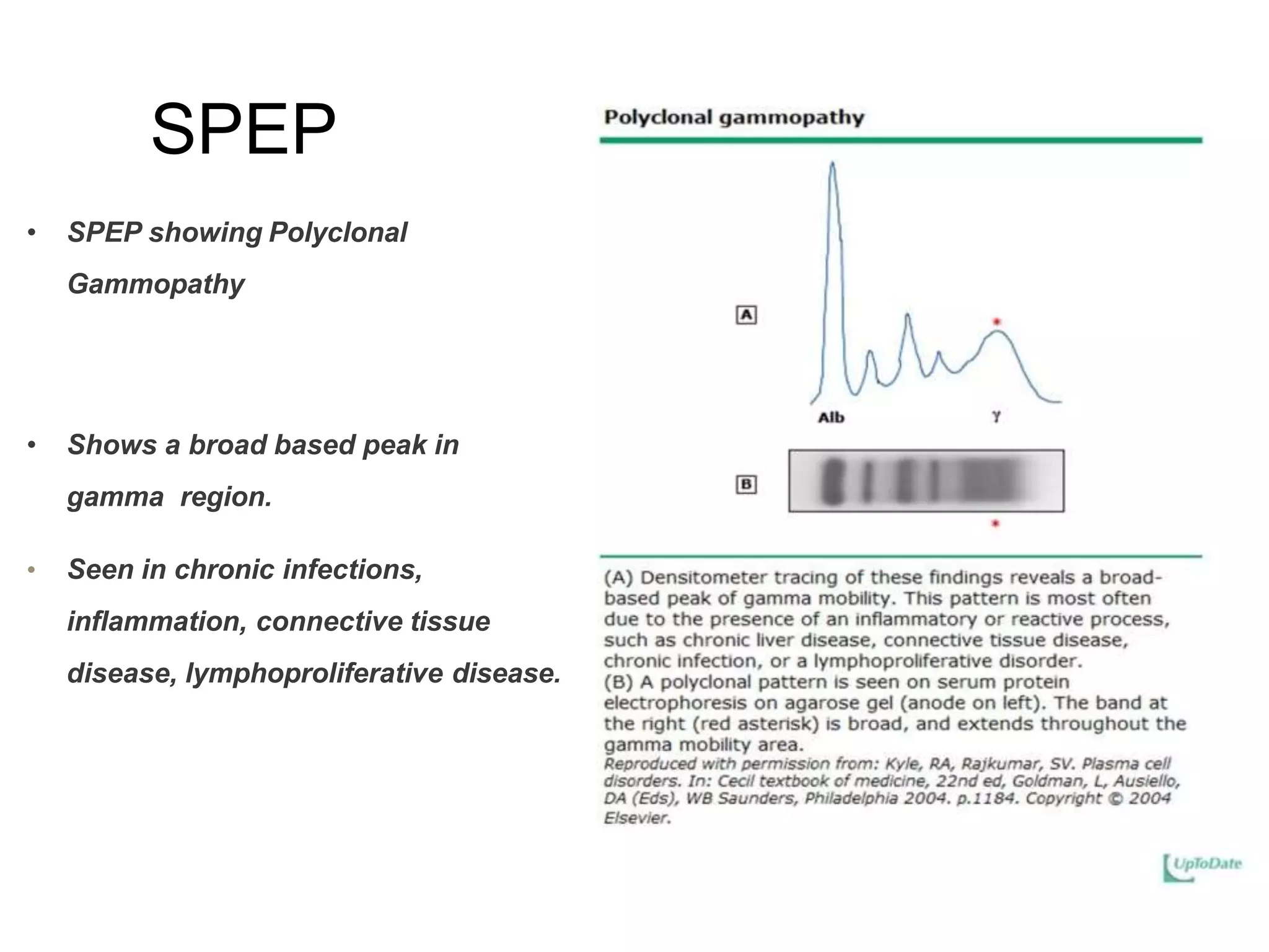Plasma Cell Disorders | PPTX