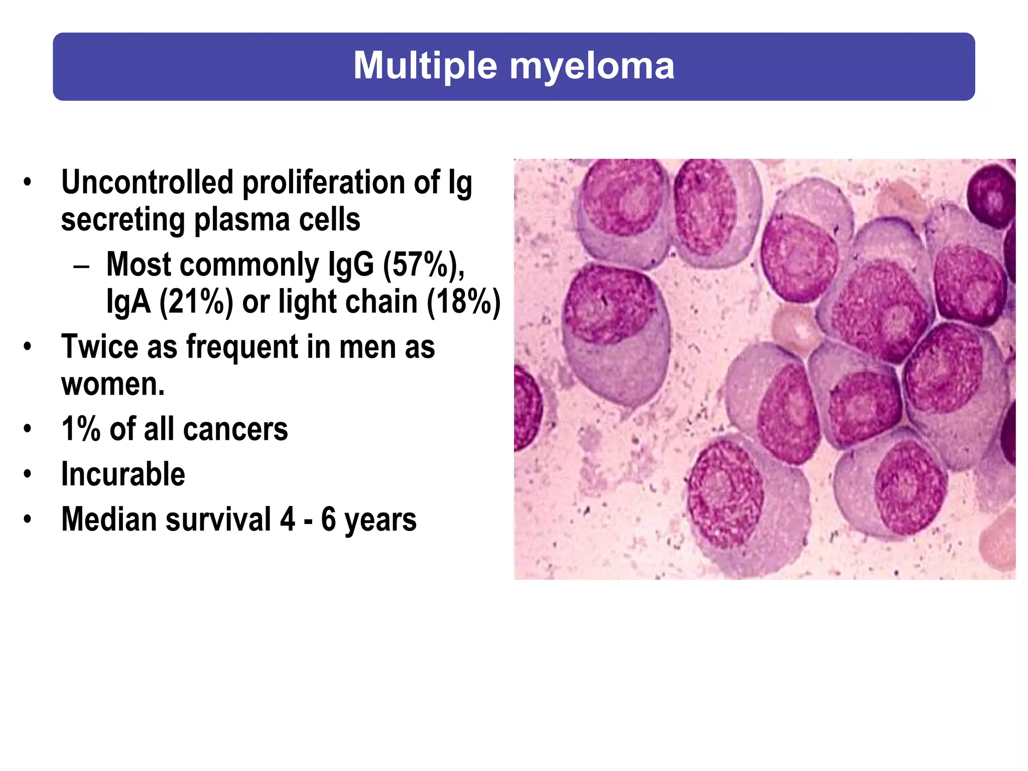 Plasma Cell Disorders | PPTX
