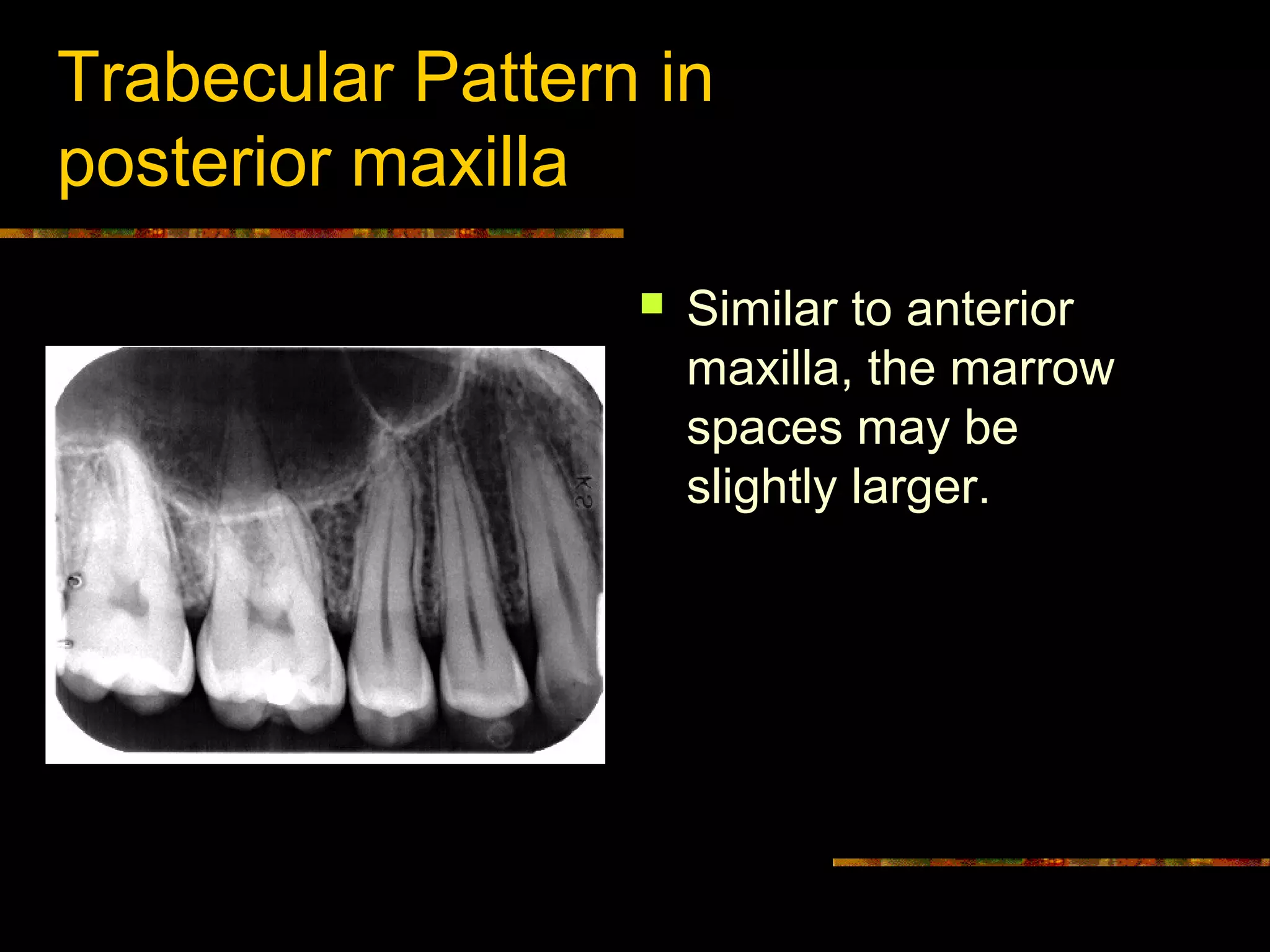 Intra Oral radiographic anatomical landmarks | PPT