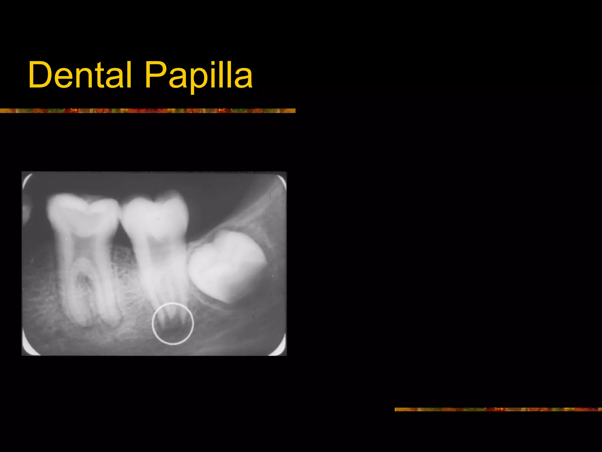 Intra Oral radiographic anatomical landmarks | PPT