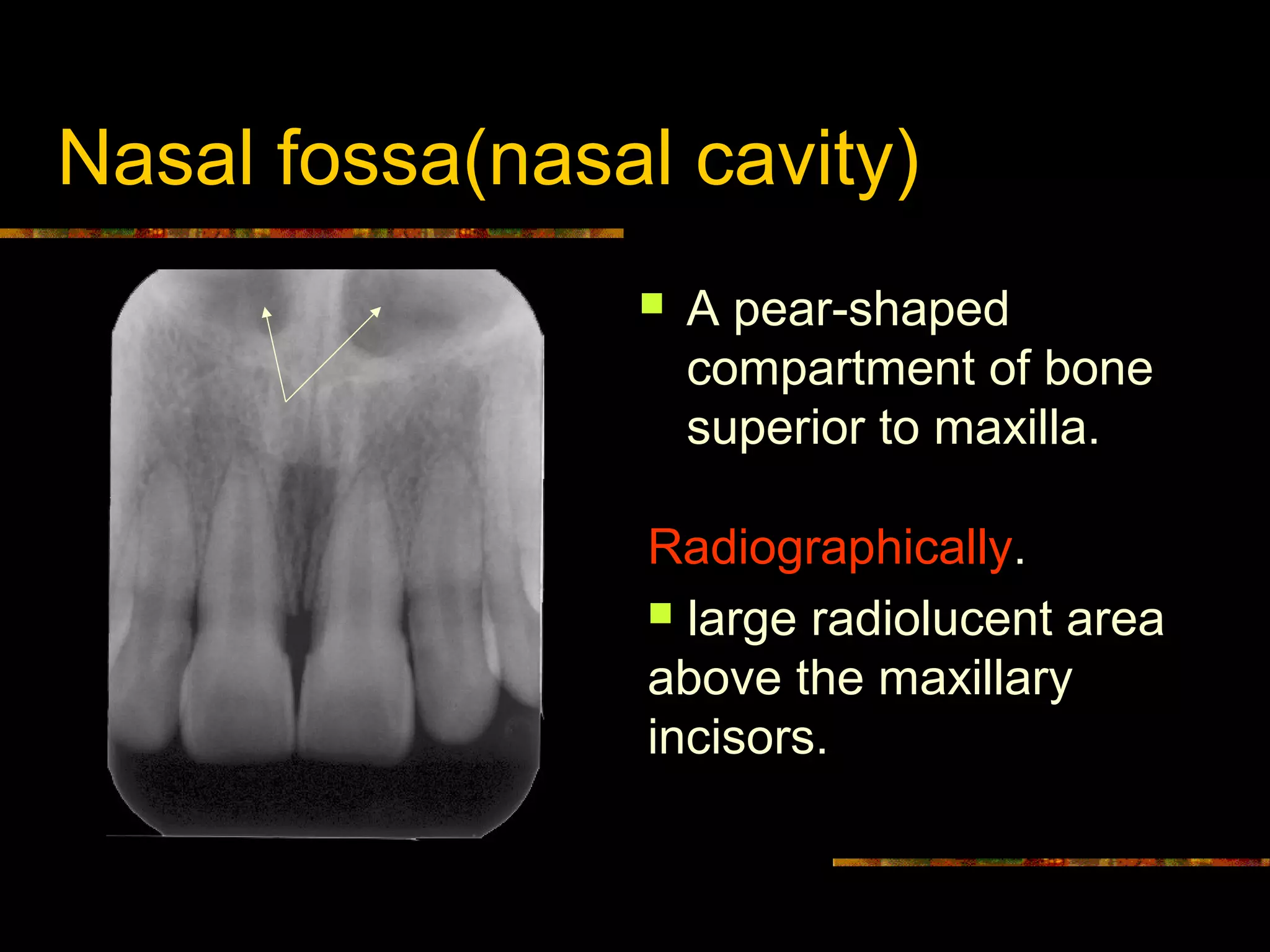 Intra Oral radiographic anatomical landmarks | PPT