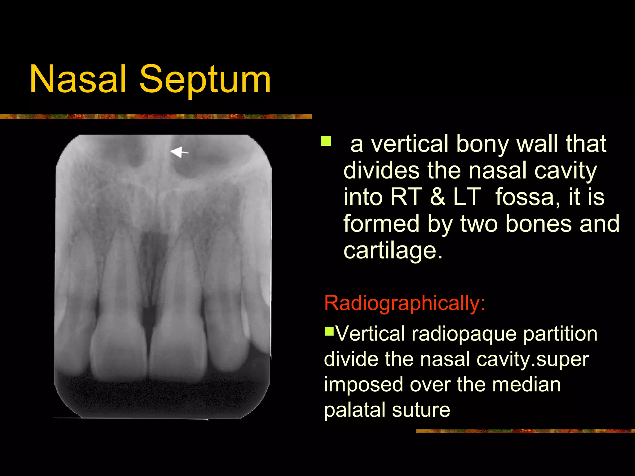 Intra Oral radiographic anatomical landmarks | PPT