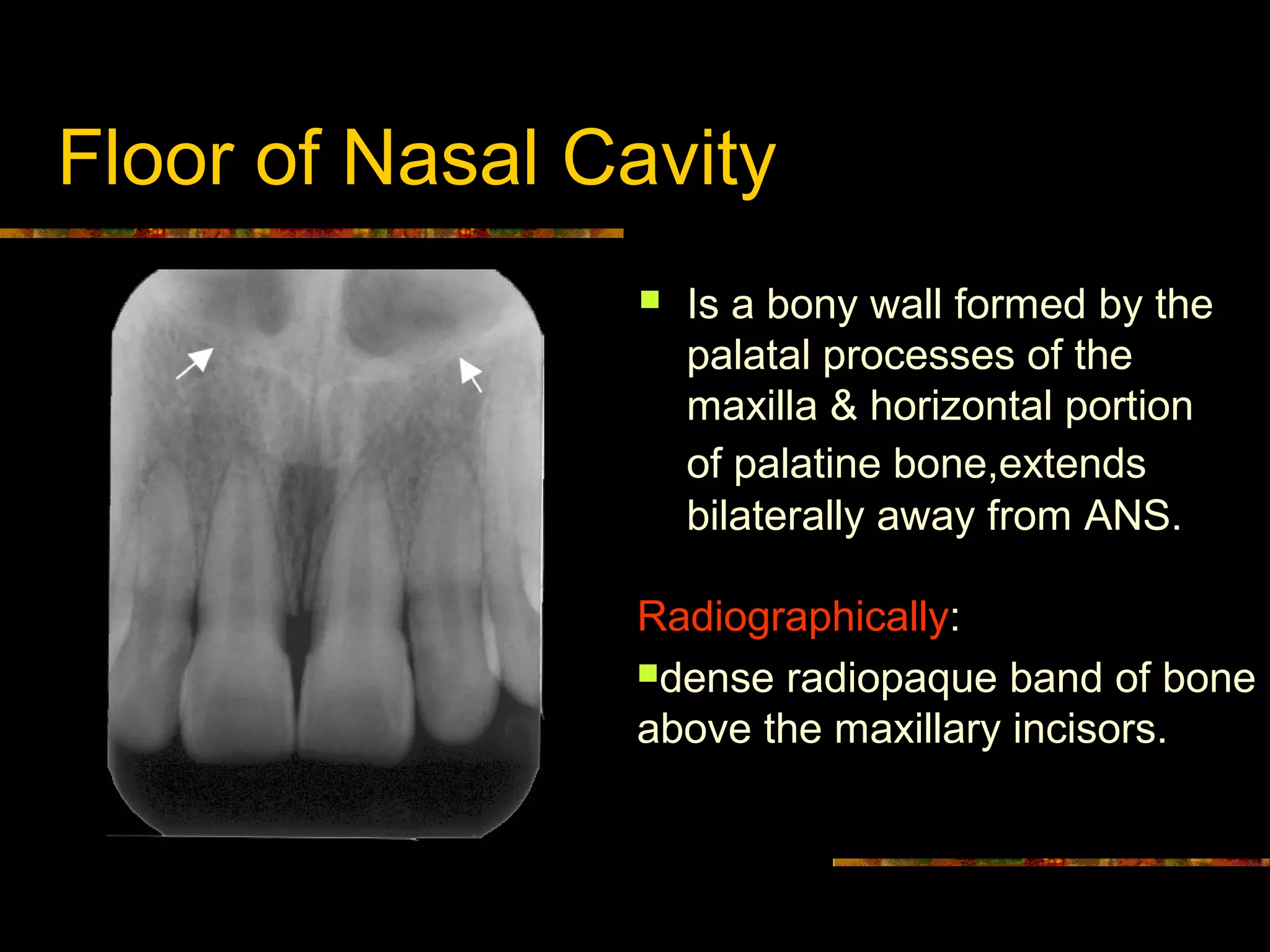 Intra Oral radiographic anatomical landmarks | PPT