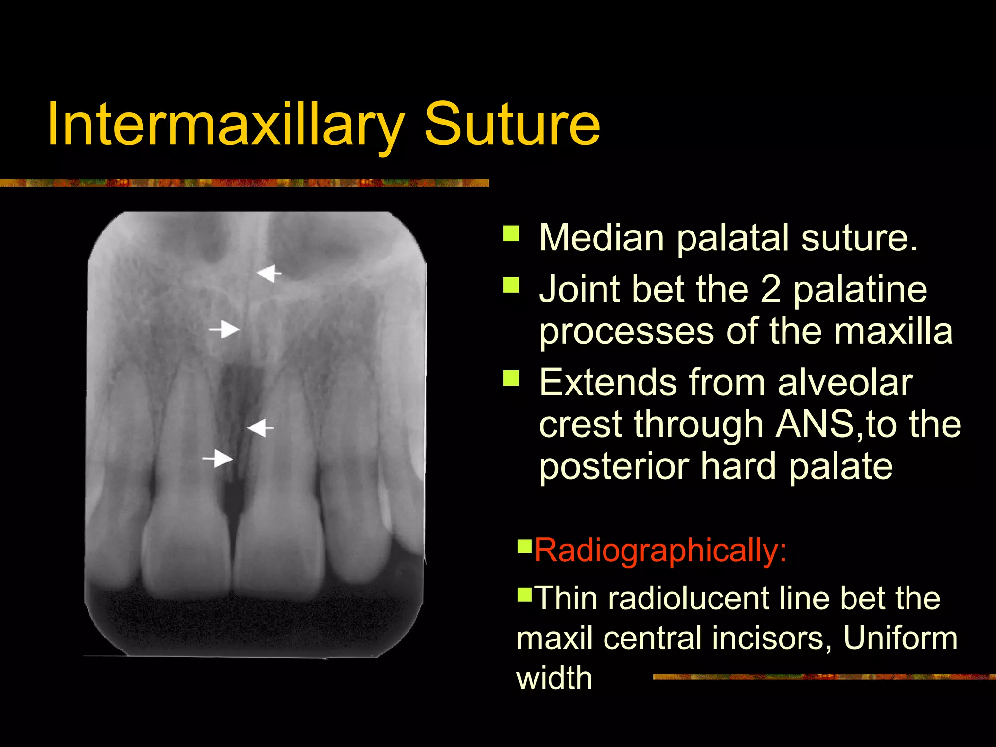 Intra Oral radiographic anatomical landmarks | PPT