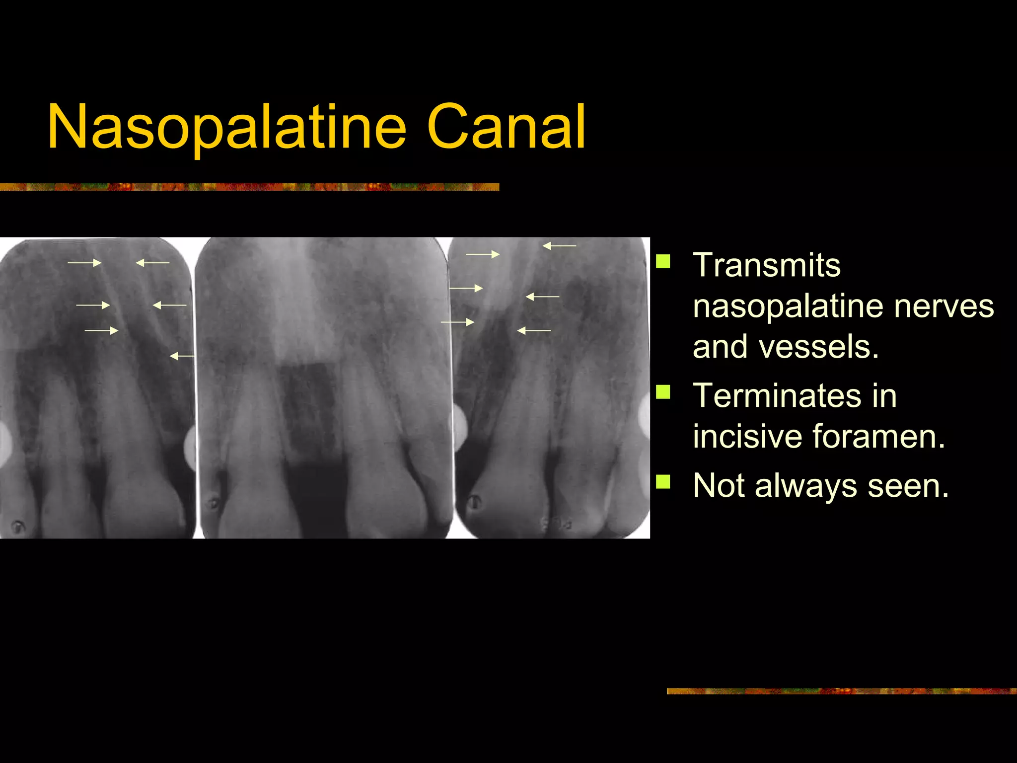 Intra Oral radiographic anatomical landmarks | PPT