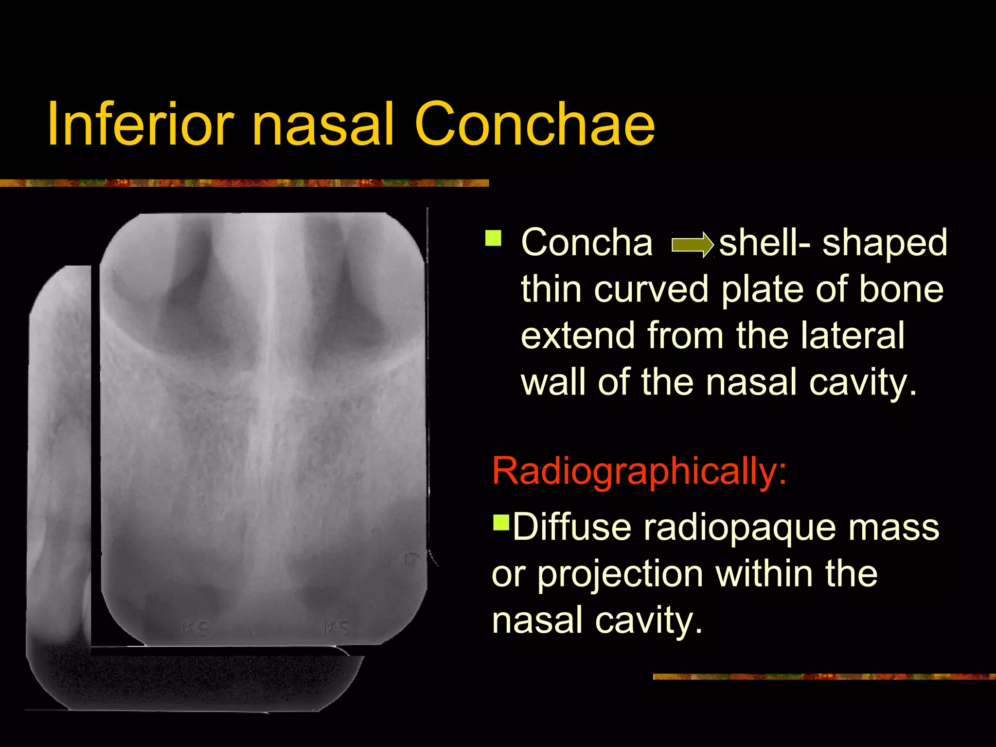 Intra Oral radiographic anatomical landmarks | PPT