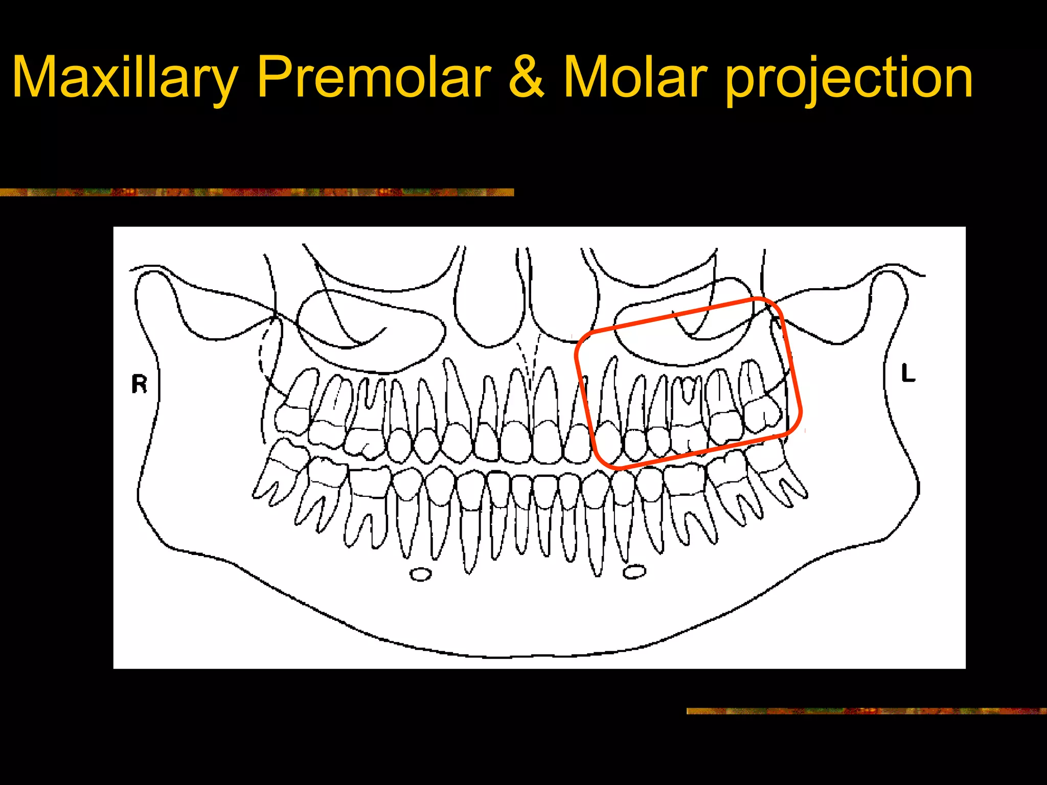 Intra Oral radiographic anatomical landmarks | PPT