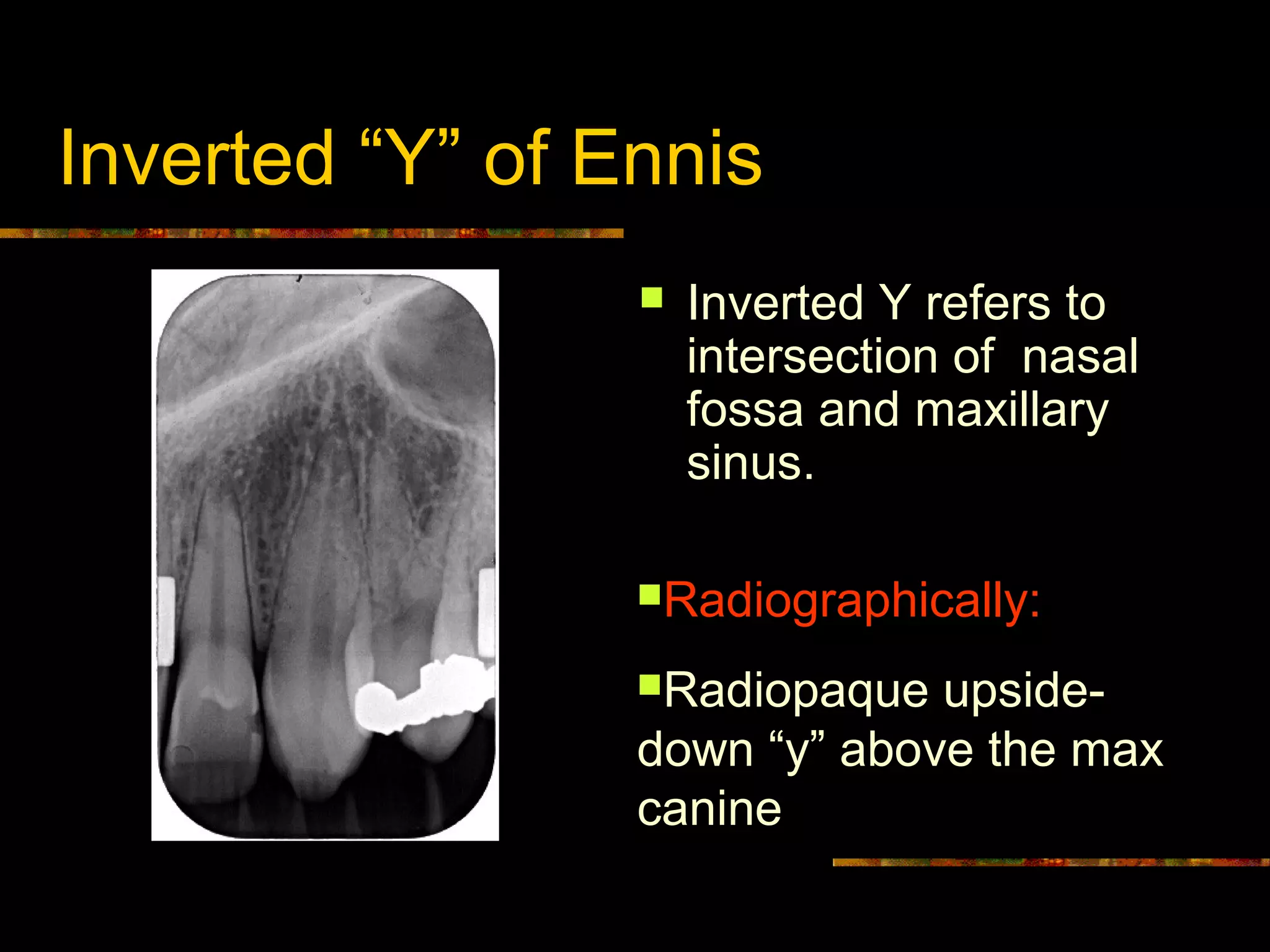 Intra Oral radiographic anatomical landmarks | PPT