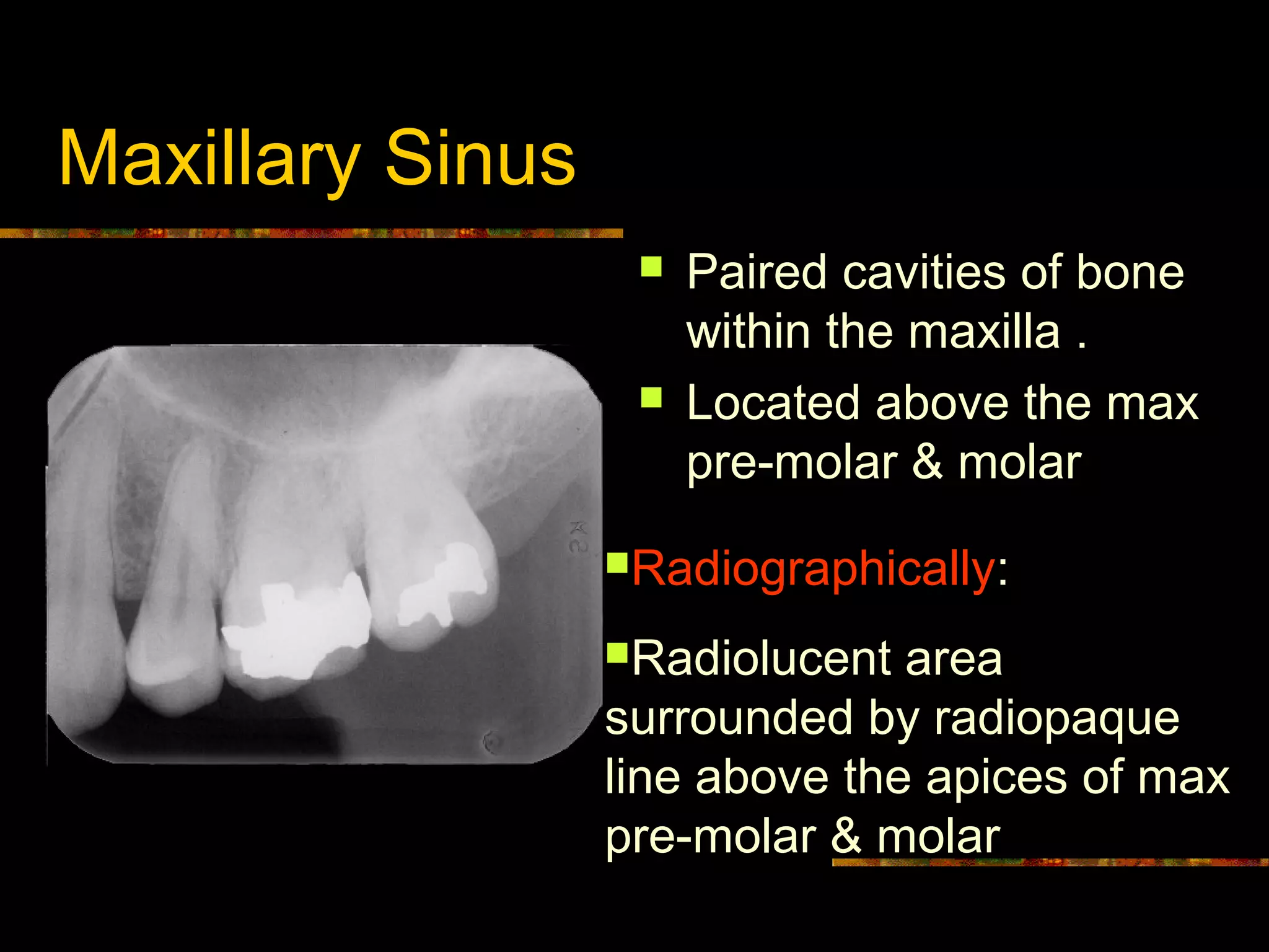 Intra Oral radiographic anatomical landmarks | PPT