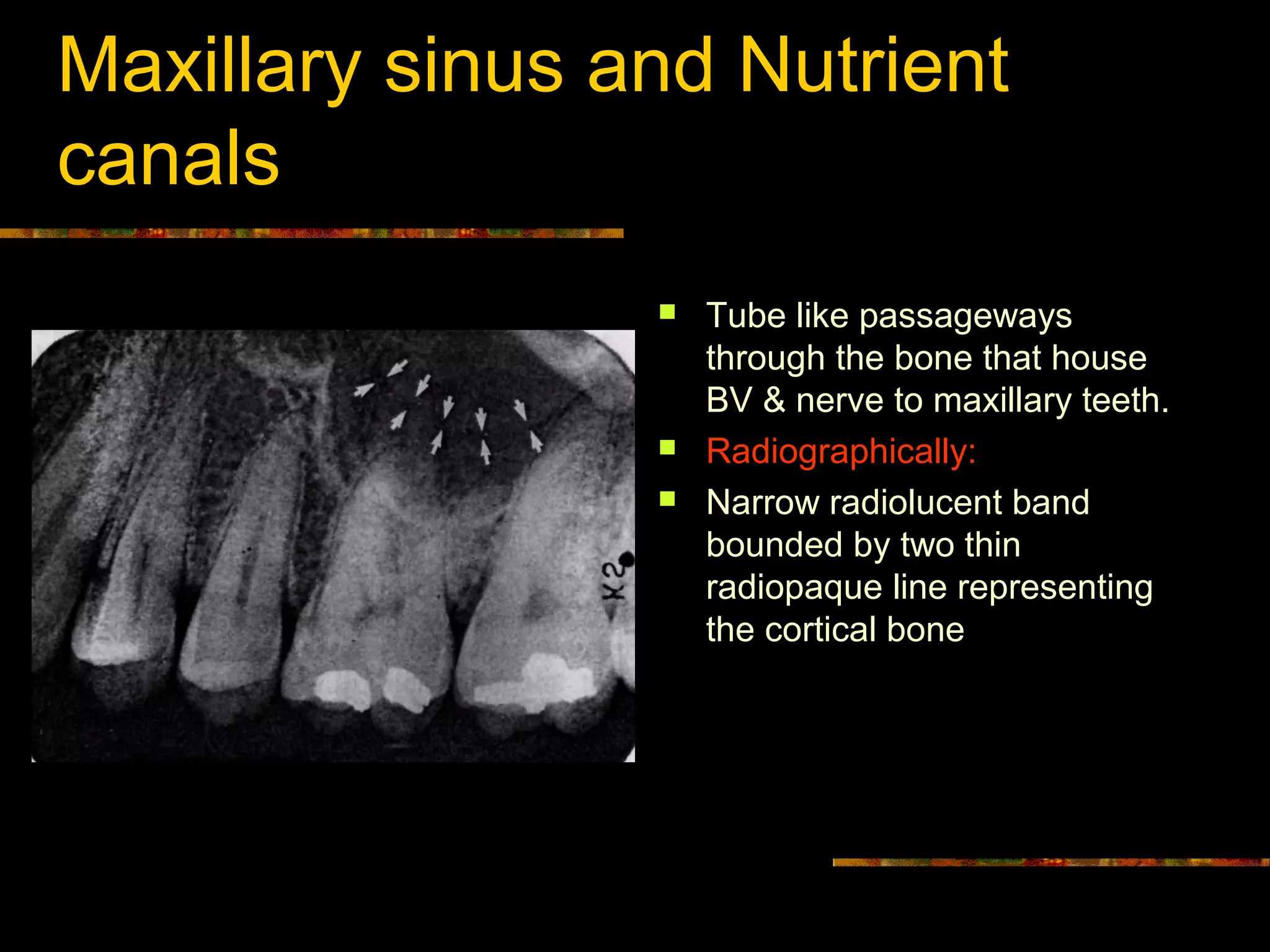 Intra Oral radiographic anatomical landmarks | PPT