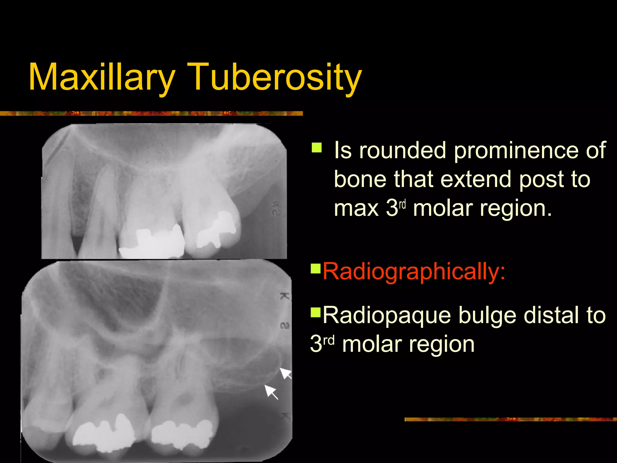 Intra Oral radiographic anatomical landmarks | PPT