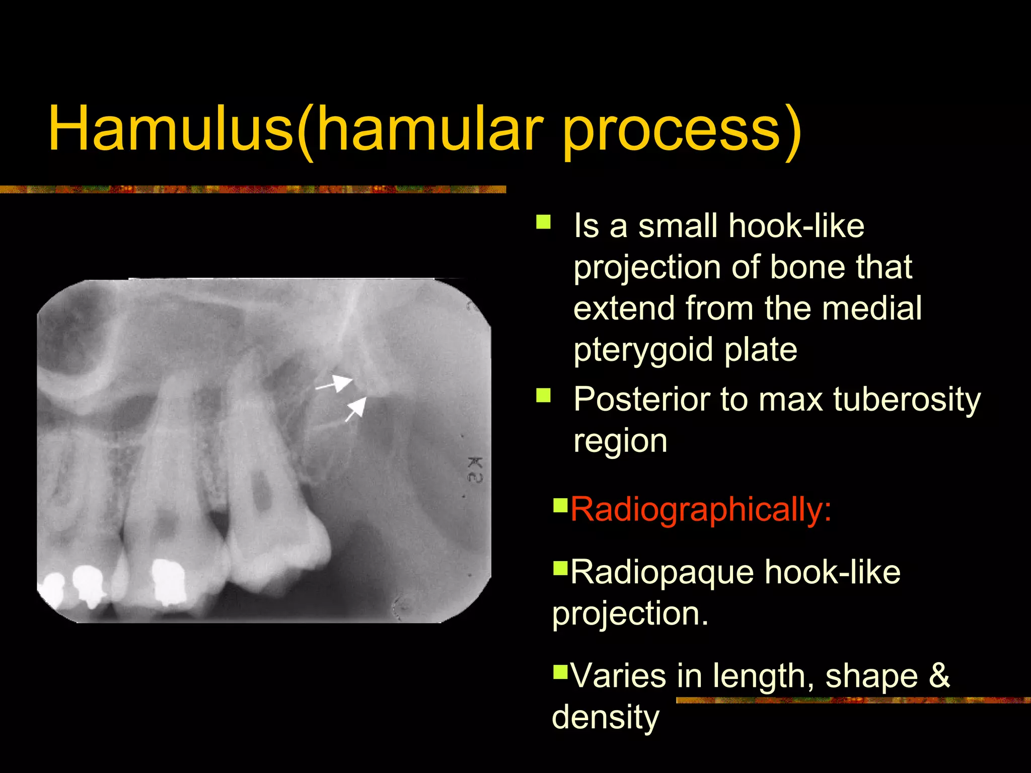 Intra Oral radiographic anatomical landmarks | PPT