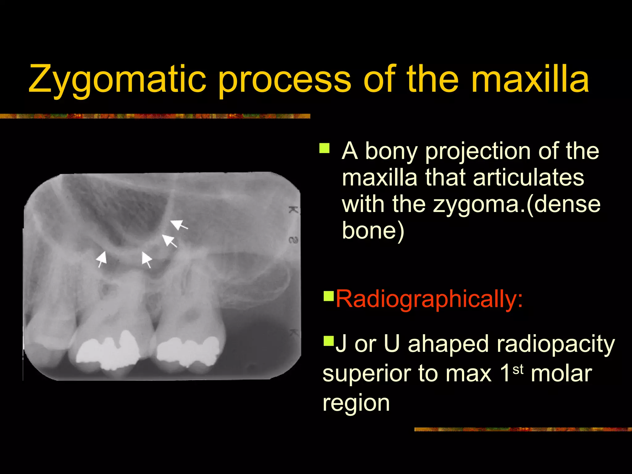 Intra Oral radiographic anatomical landmarks | PPT