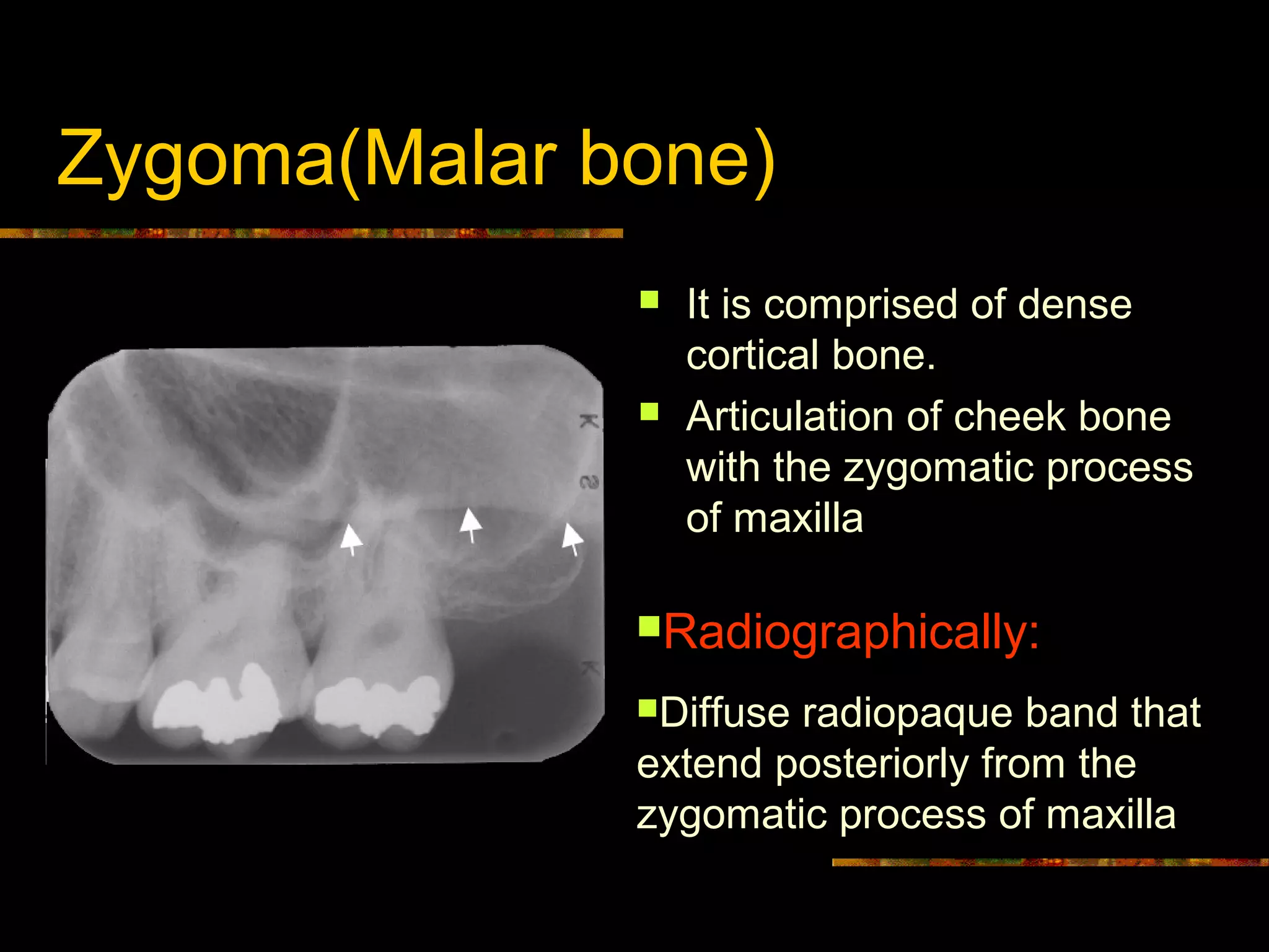 Intra Oral radiographic anatomical landmarks | PPT