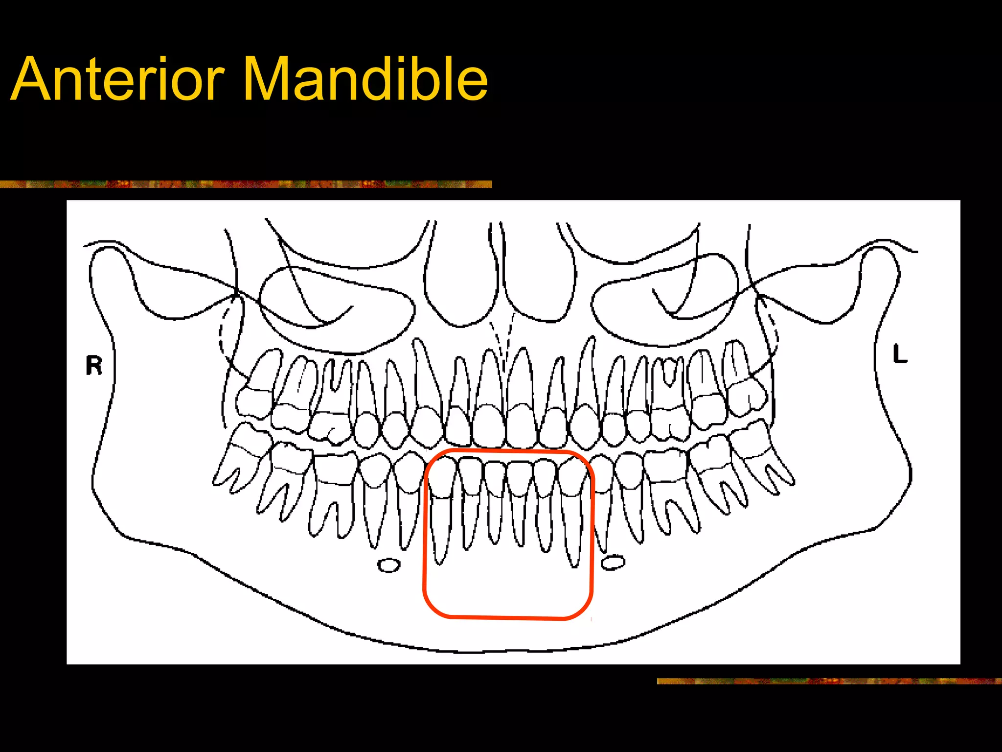 Intra Oral radiographic anatomical landmarks | PPT