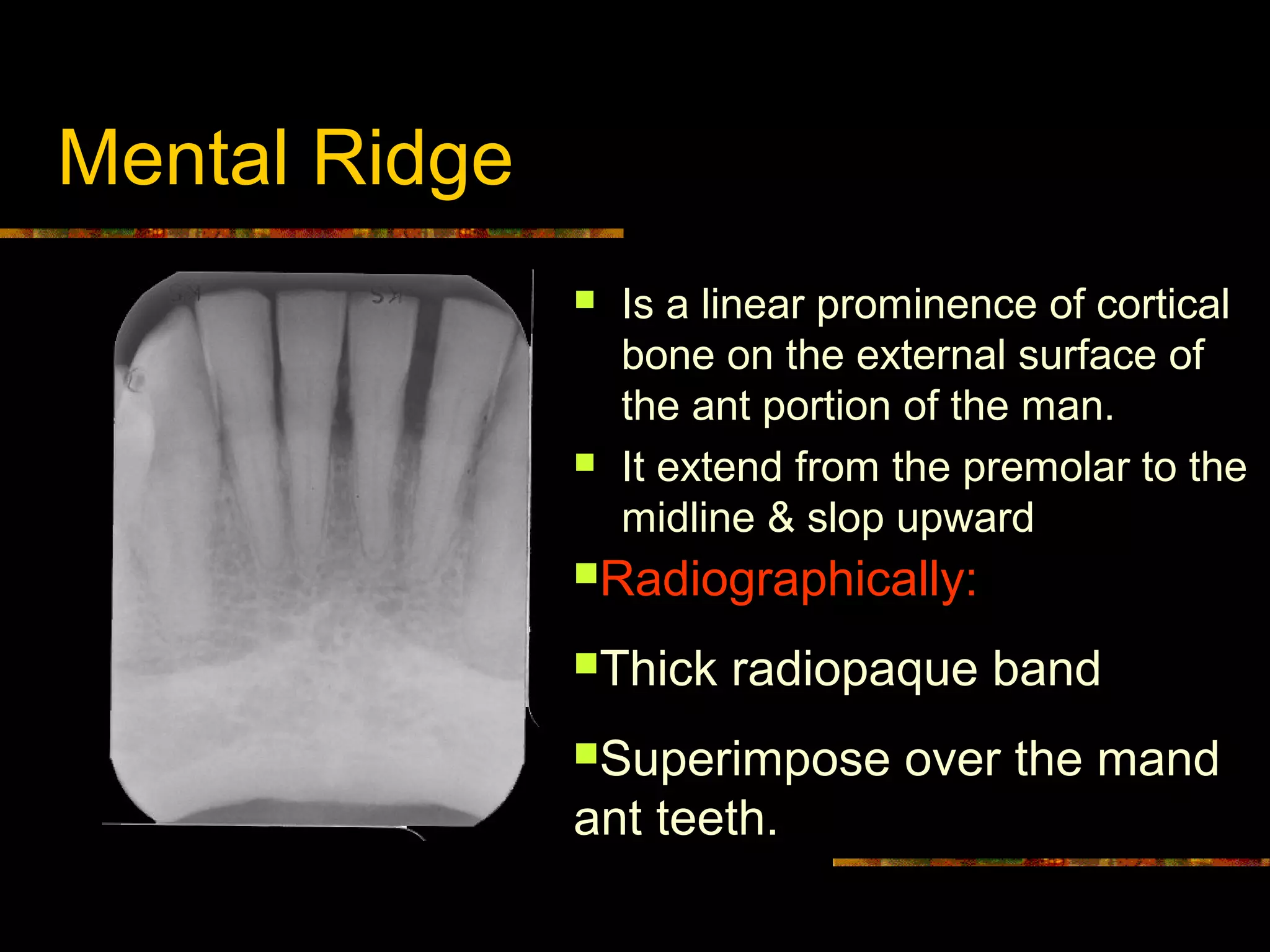 Intra Oral radiographic anatomical landmarks | PPT