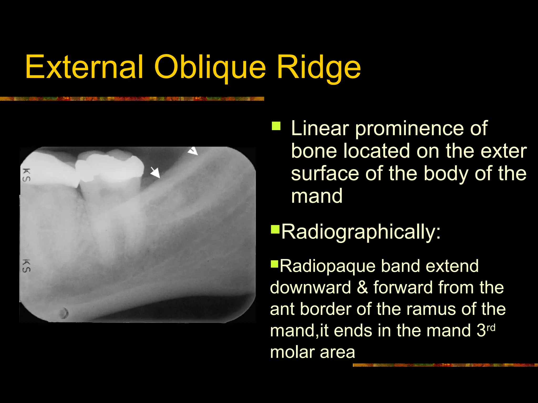 Intra Oral radiographic anatomical landmarks | PPT