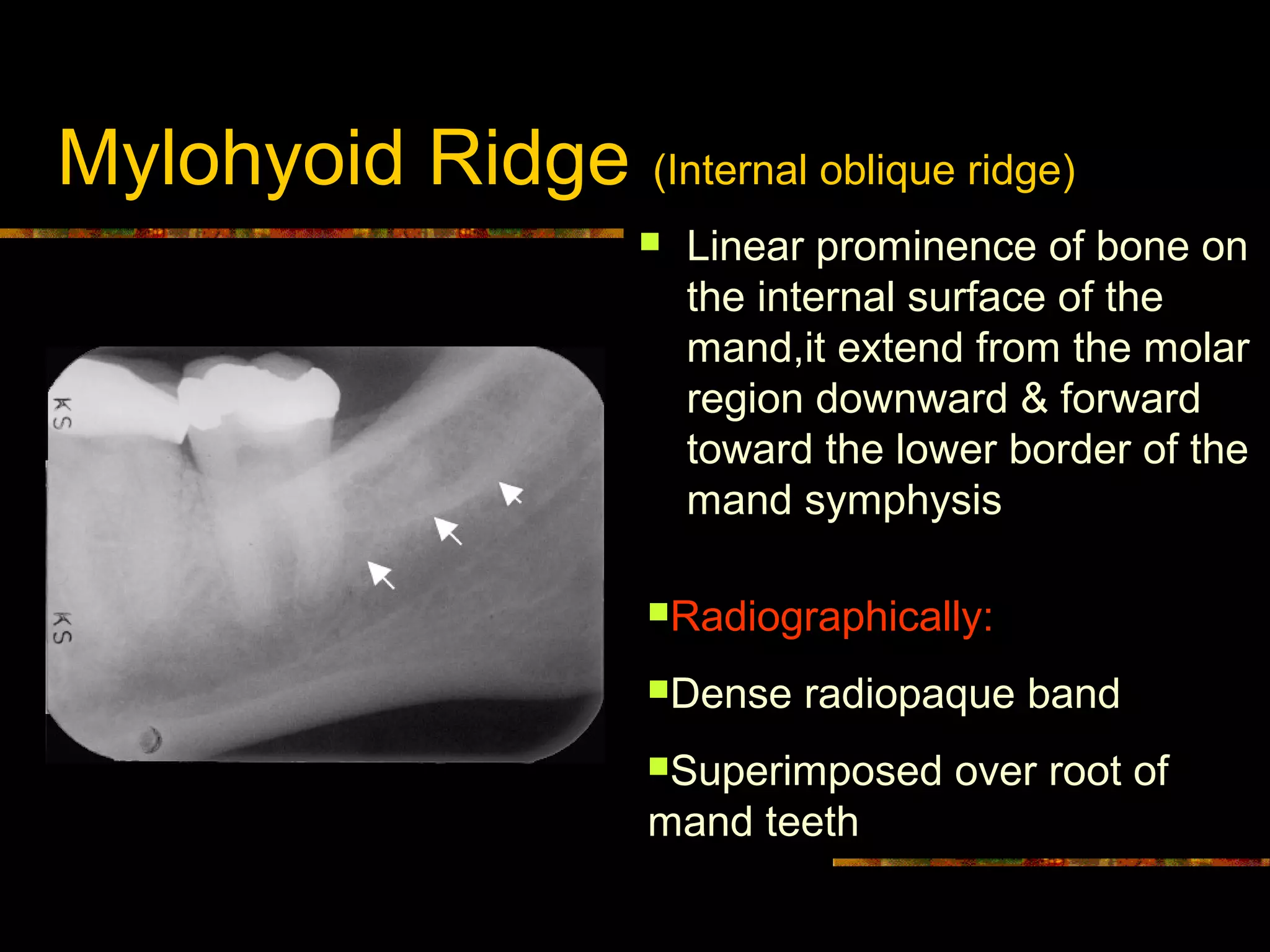Intra Oral radiographic anatomical landmarks | PPT