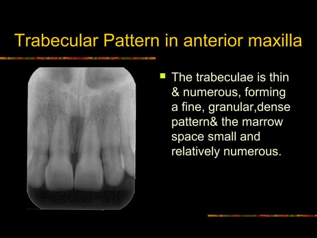 Intra Oral radiographic anatomical landmarks | PPT