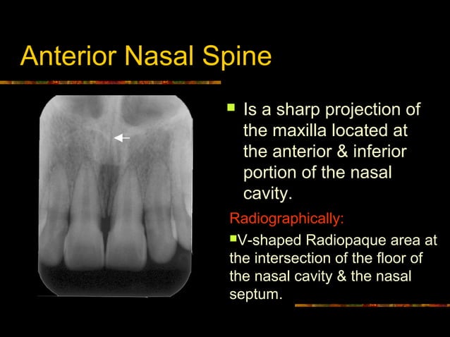 Intra Oral radiographic anatomical landmarks | PPT