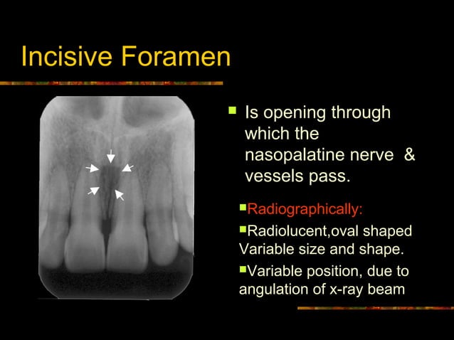 Intra Oral radiographic anatomical landmarks | PPT