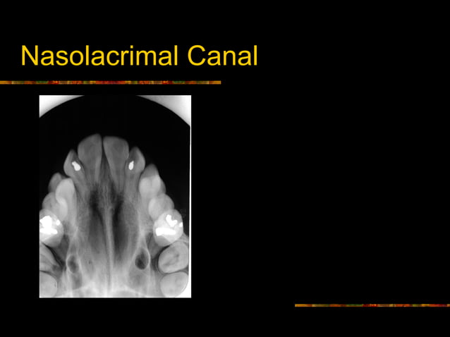 Intra Oral radiographic anatomical landmarks | PPT