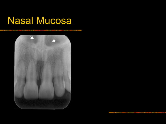 Intra Oral radiographic anatomical landmarks | PPT