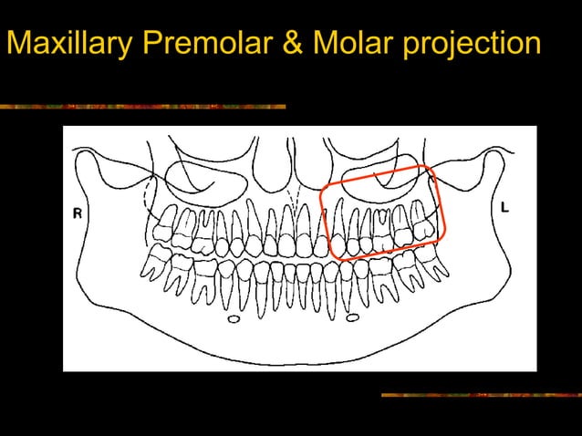 Intra Oral radiographic anatomical landmarks | PPT