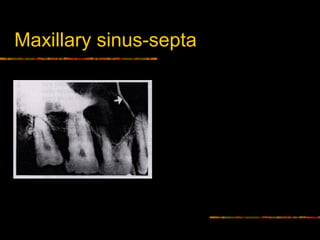 Intra Oral radiographic anatomical landmarks | PPT