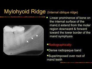Intra Oral radiographic anatomical landmarks | PPT