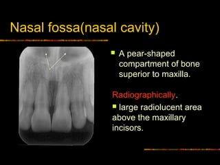 Inferior Nasal Concha Radiograph