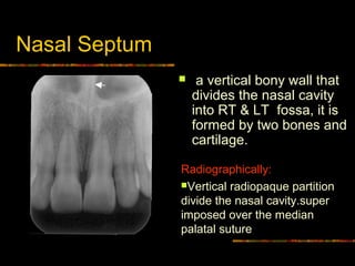 Nasal Septum Radiograph