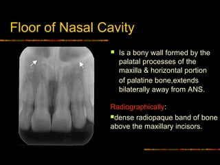 Intra Oral radiographic anatomical landmarks | PPT