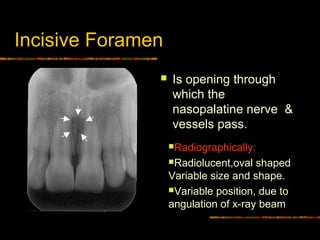 Intra Oral radiographic anatomical landmarks | PPT