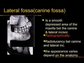 Intra Oral radiographic anatomical landmarks | PPT