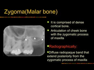 Zygoma Radiograph