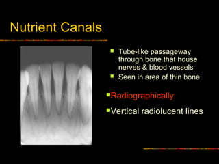 Nutrient Canal Radiograph