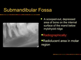 Submandibular Fossa Radiograph