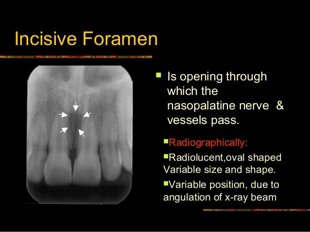 Intra Oral radiographic anatomical landmarks
