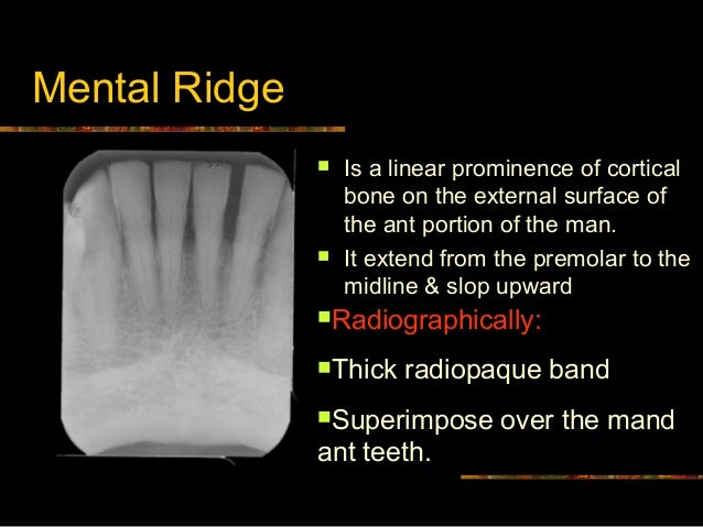 Intra Oral radiographic anatomical landmarks