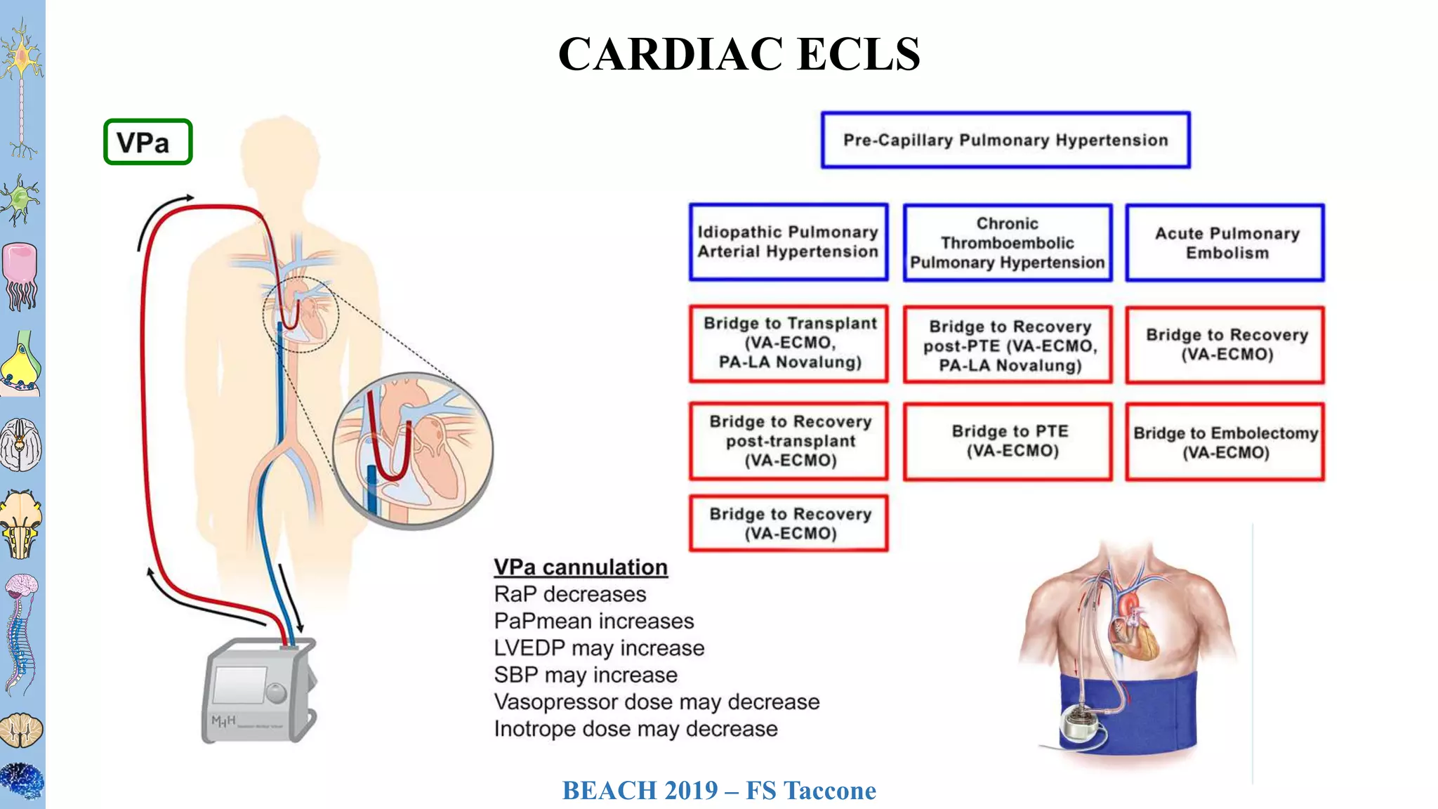 3. ecmo different modes and principles va vv #beach2019 (taccone) | PPT