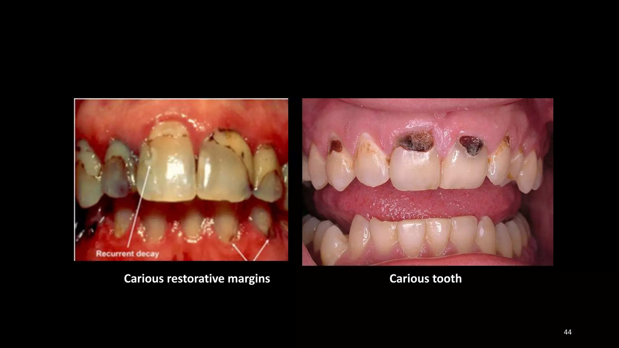 Aesthetic problem solving part 1 | PPT