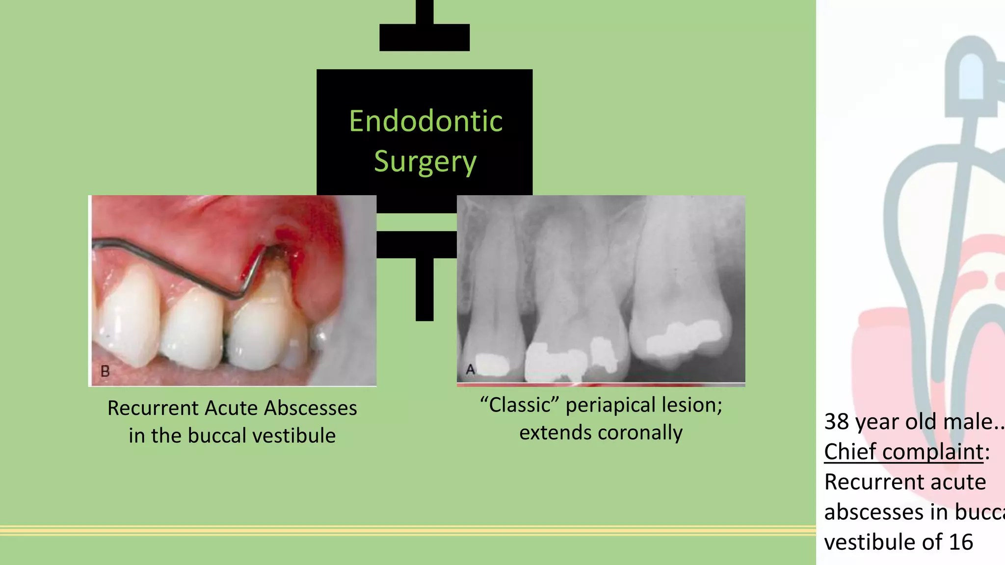 Rationale of endodontics | PPTX