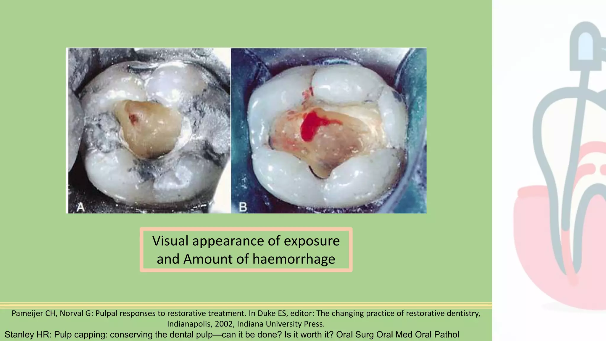 Rationale of endodontics | PPTX