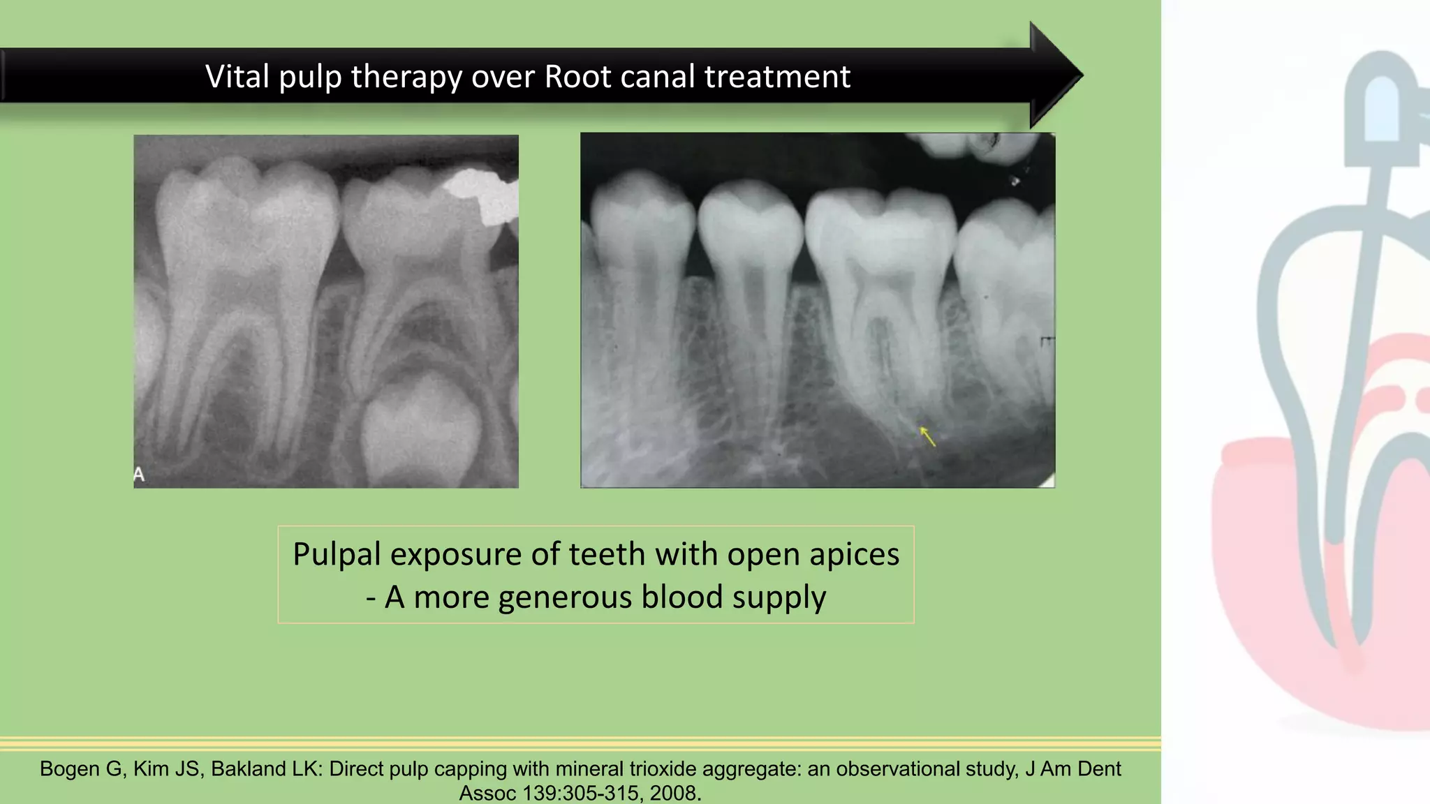 Rationale of endodontics | PPTX