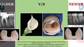Rationale of endodontics | PPTX