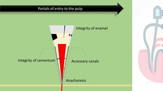 Rationale of endodontics | PPTX