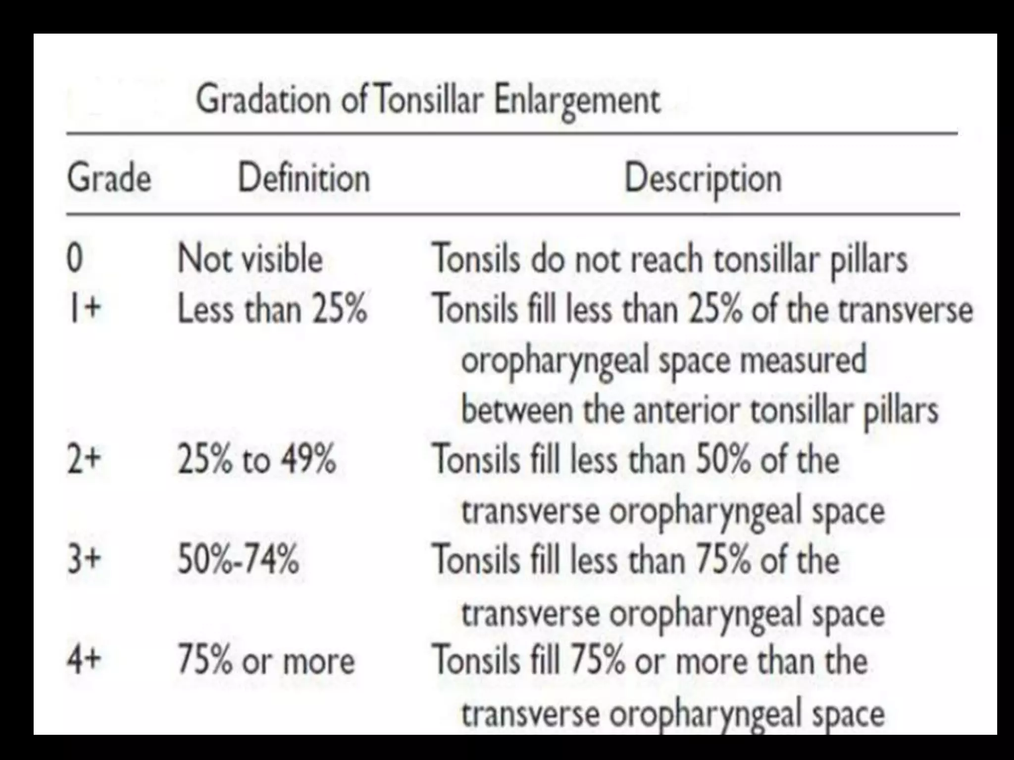 Tonsils and adenoids | PPT