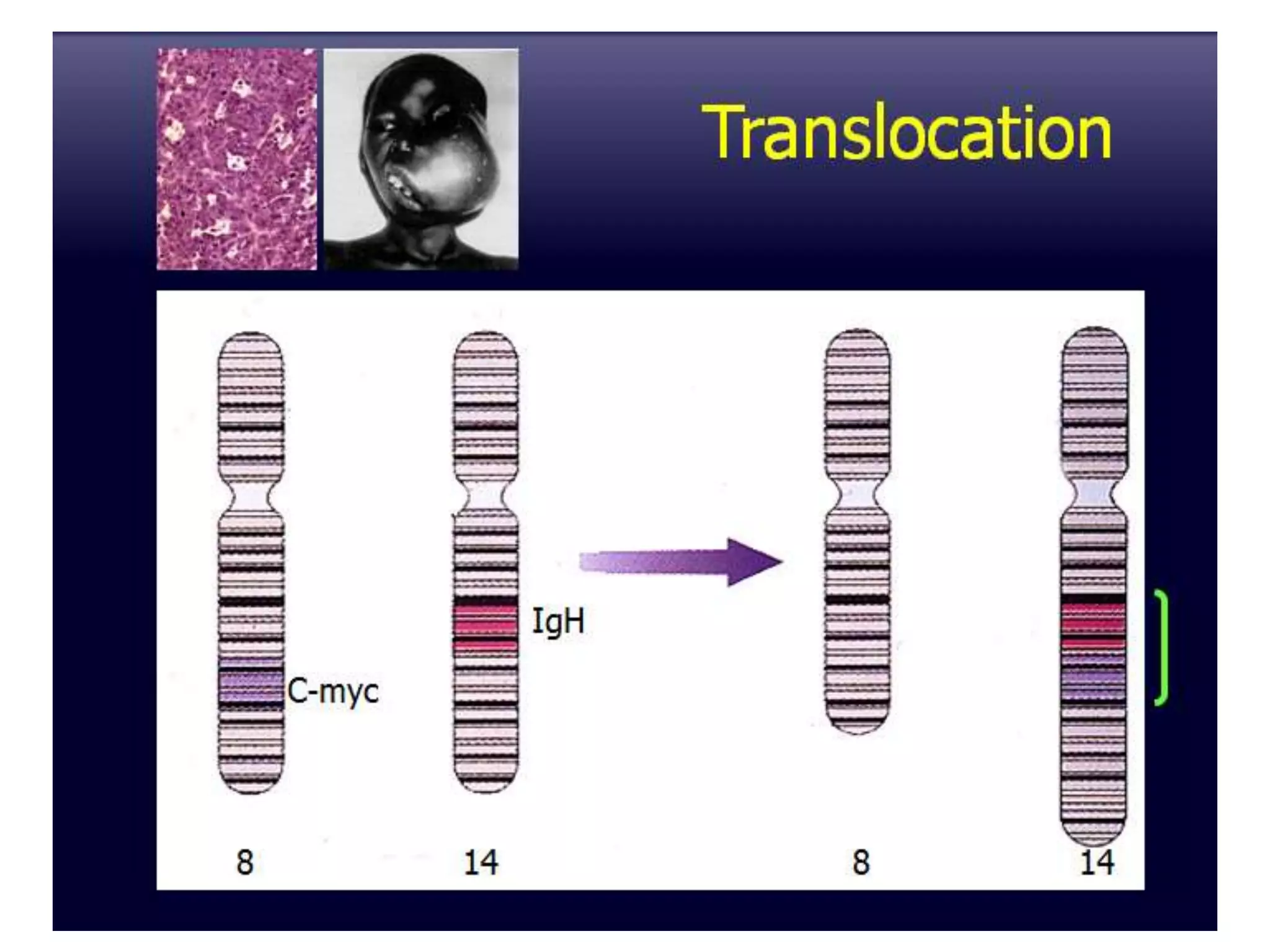 molecular pathogenesis of carcinogenesis | PPT